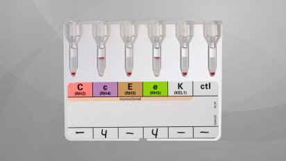 Blood Typing, Screening & Antibody Identification | Bio-Rad