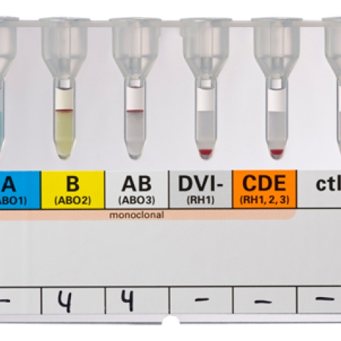 DiaClon ABO/Rh for Patients | Bio-Rad Laboratories