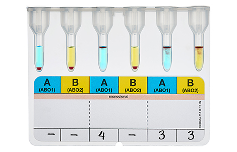 Anti-A and Anti-B | Bio-Rad
