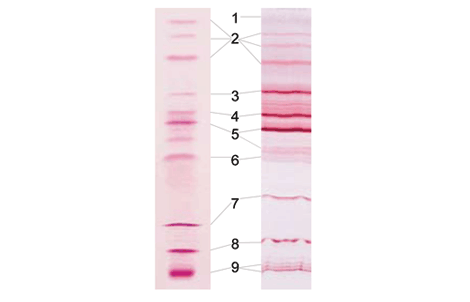IEF and 2-D Protein Standards | Bio-Rad