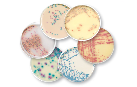 Chromogenic Culture Media | Clinical Diagnostics | Bio-Rad